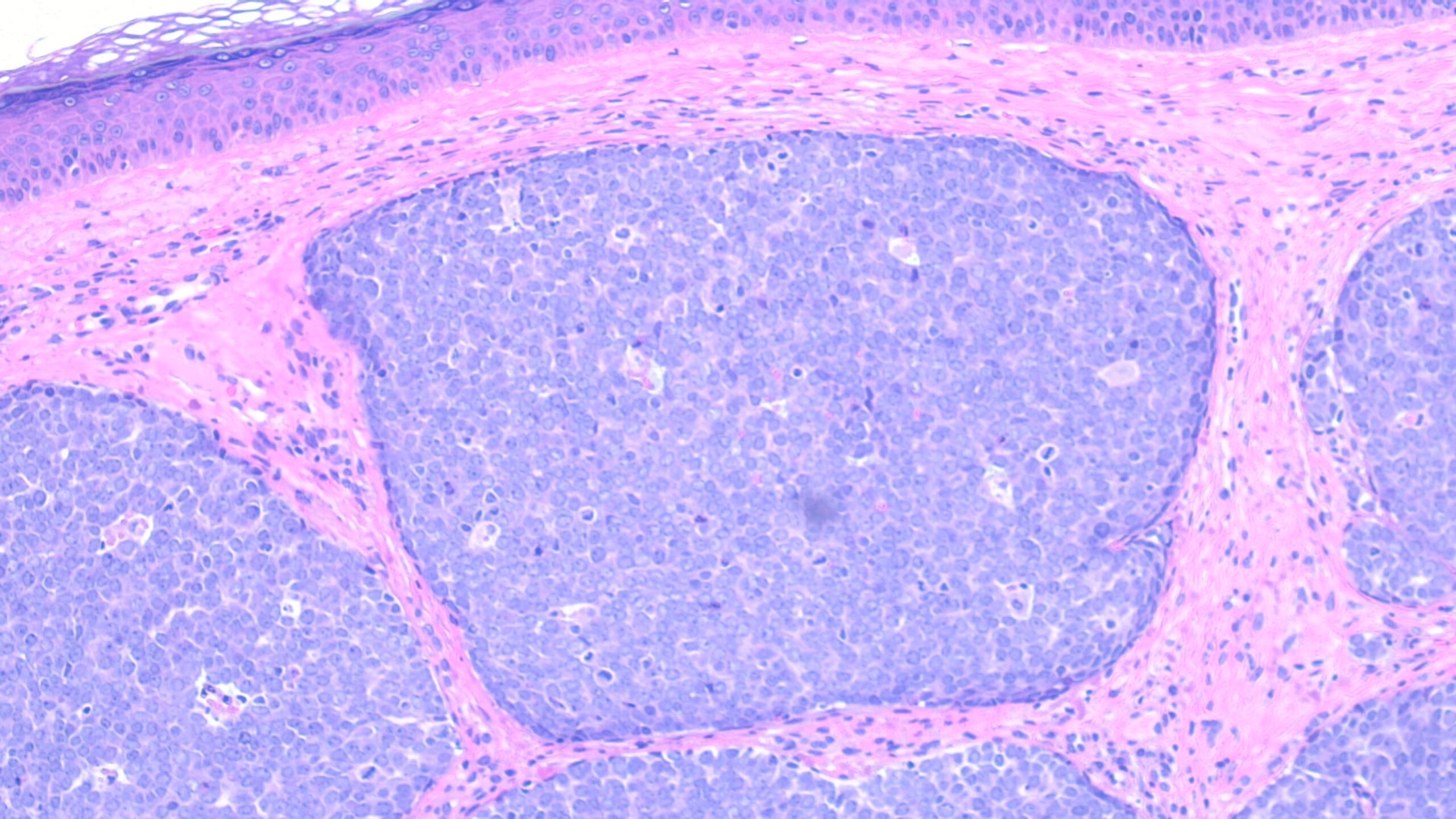 Dermatopathology – APMG