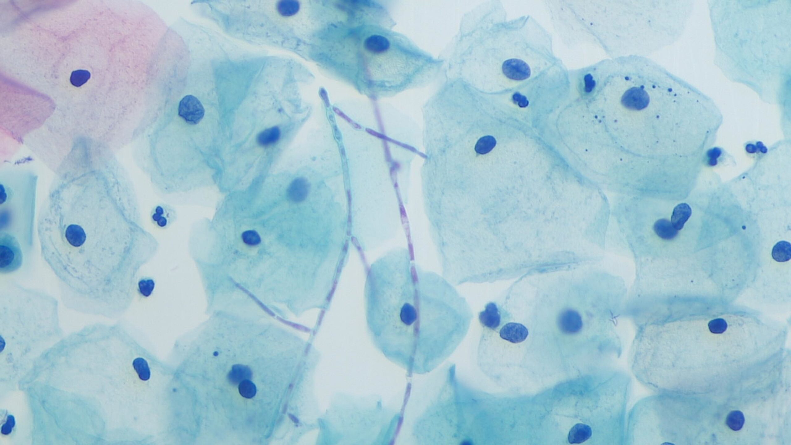 Women’s Health and Gynecologic Pathology – APMG