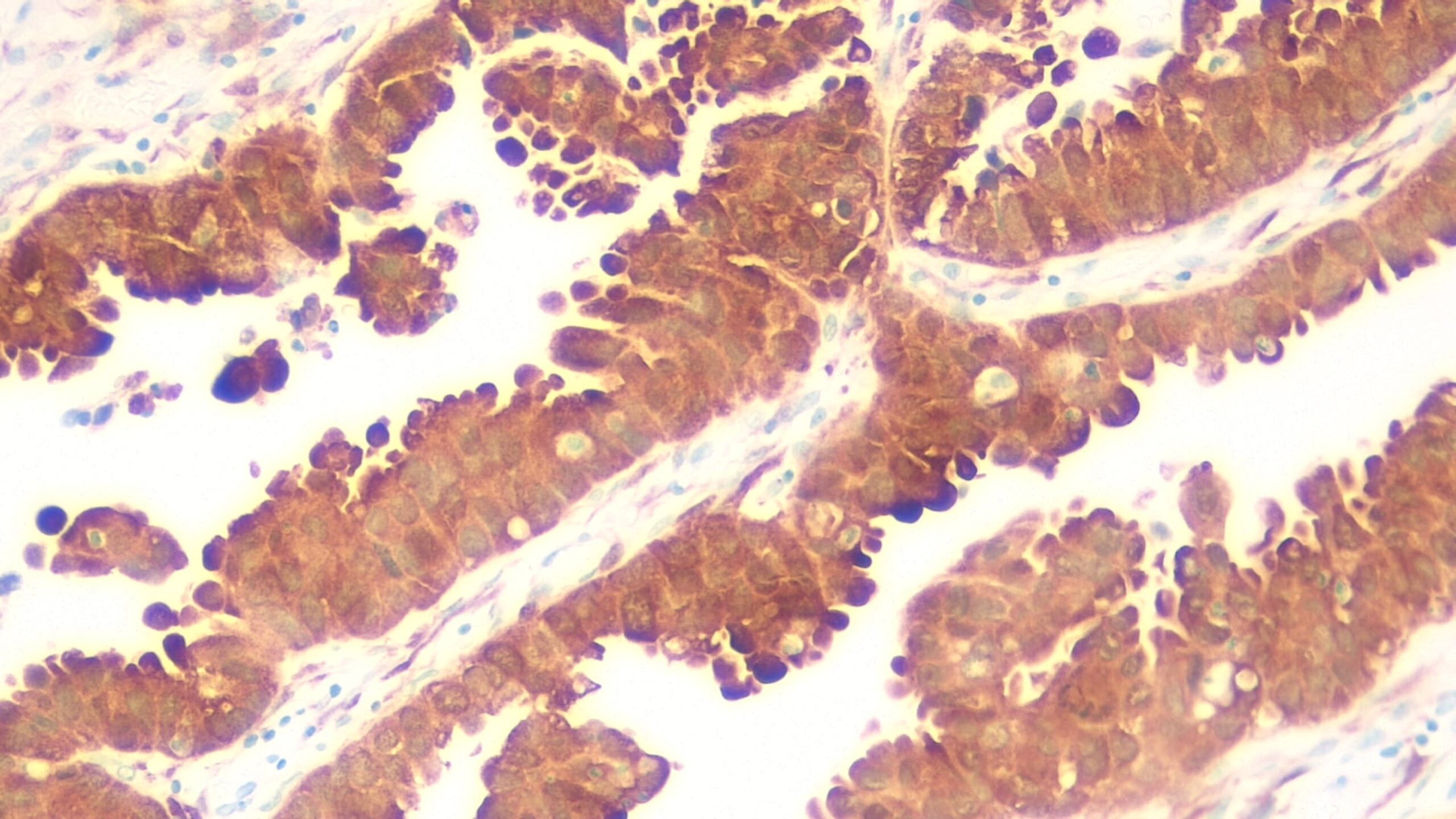 Immunohistochemistry – APMG